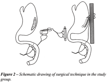 Janeway Gastrostomy Tube