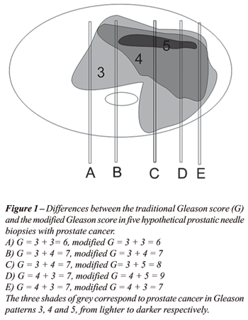 International Braz J Urol